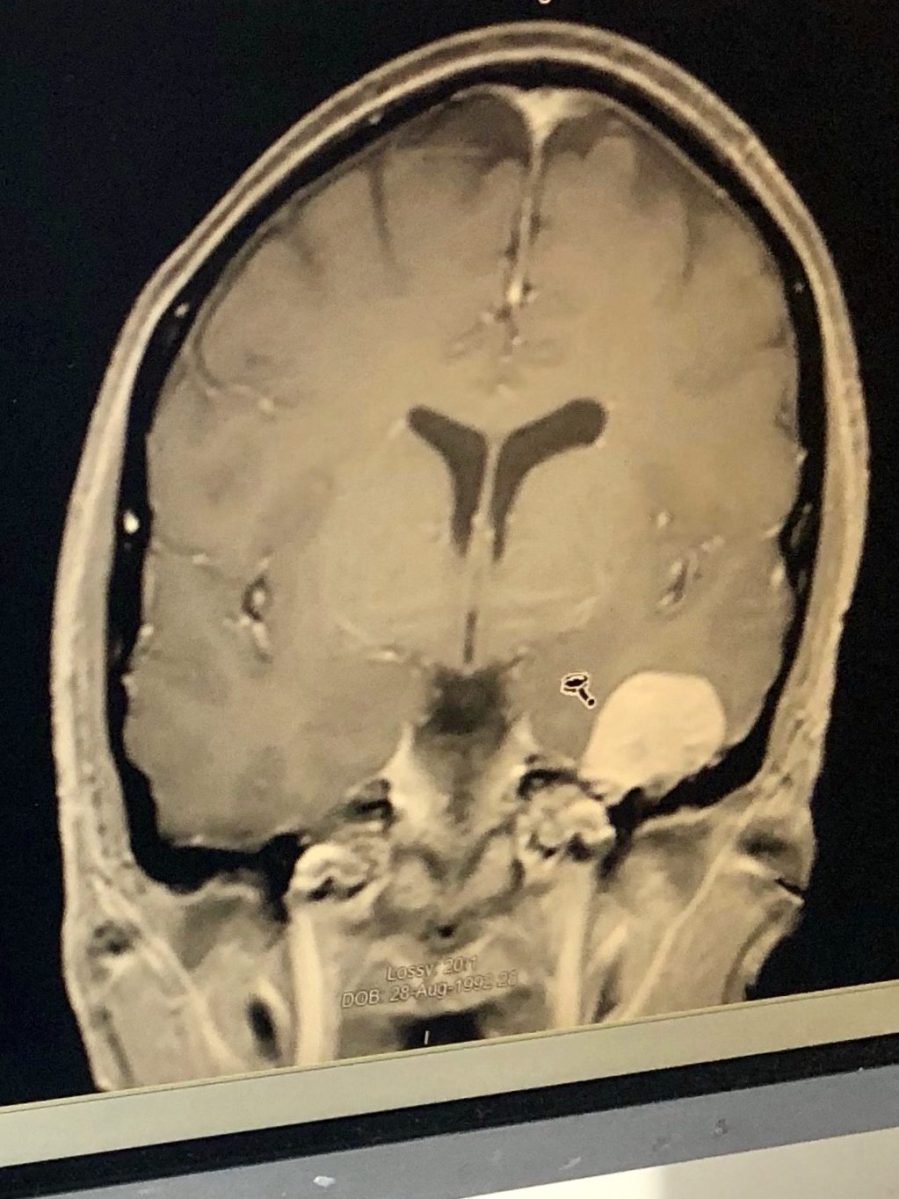 Diagnosis: Brain Tumor – Finding Grace Counseling and Wellness, LLC